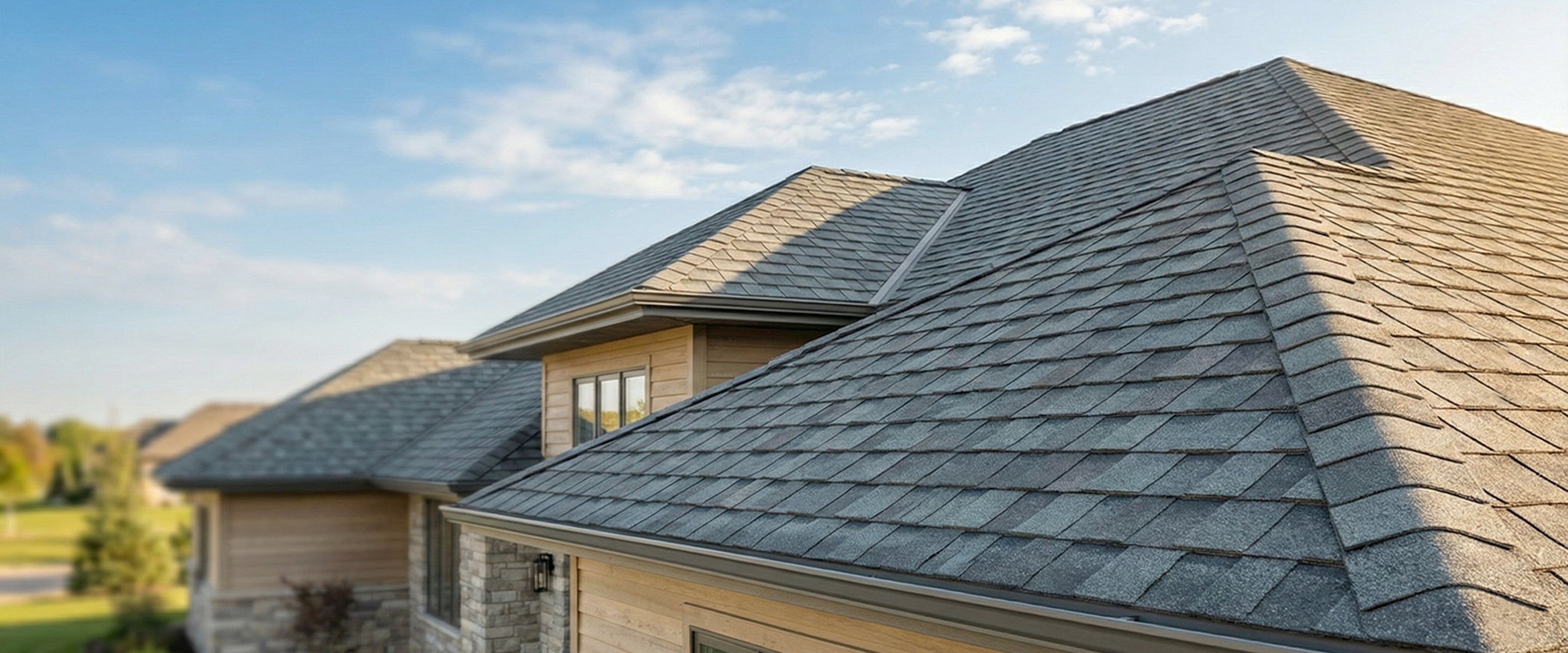 Shingles